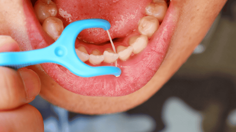 How To Floss Your Teeth: 7 Simple Steps To Flossing Properly