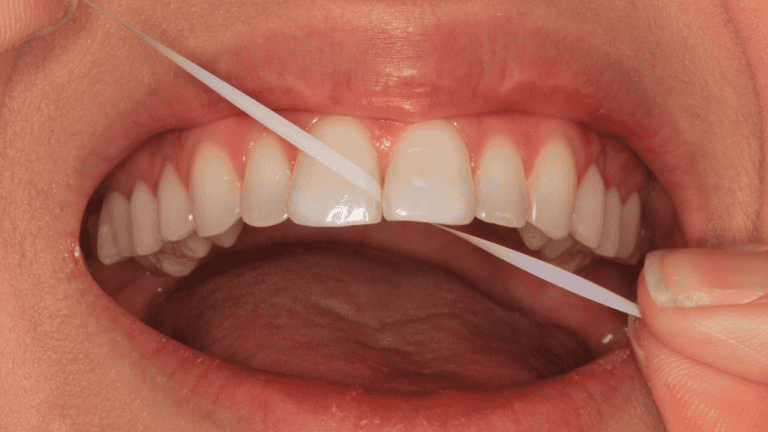 How To Floss Your Teeth: 7 Simple Steps To Flossing Properly