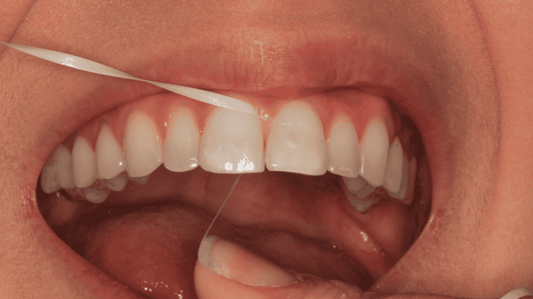 How To Floss Your Teeth: 7 Simple Steps To Flossing Properly