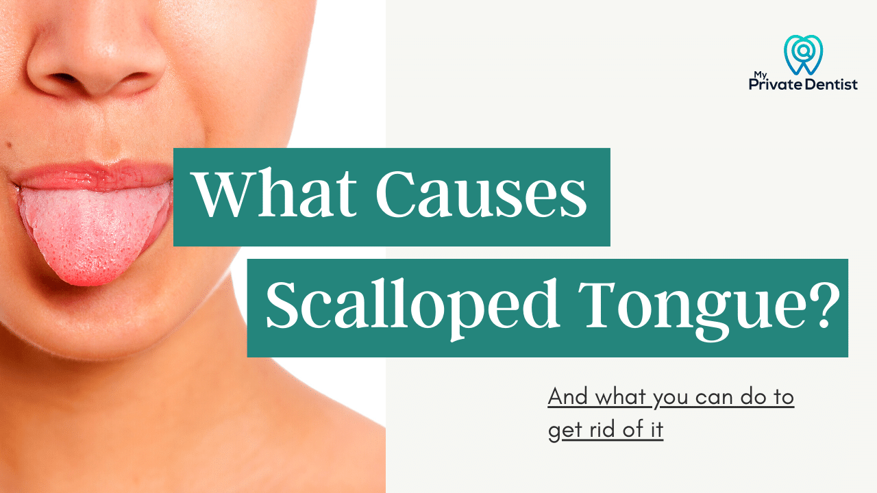Scalloped Tongue: 7 Causes And How To Treat Them