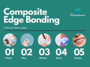 Composite Edge Bonding: 15 Things You Need To Know
