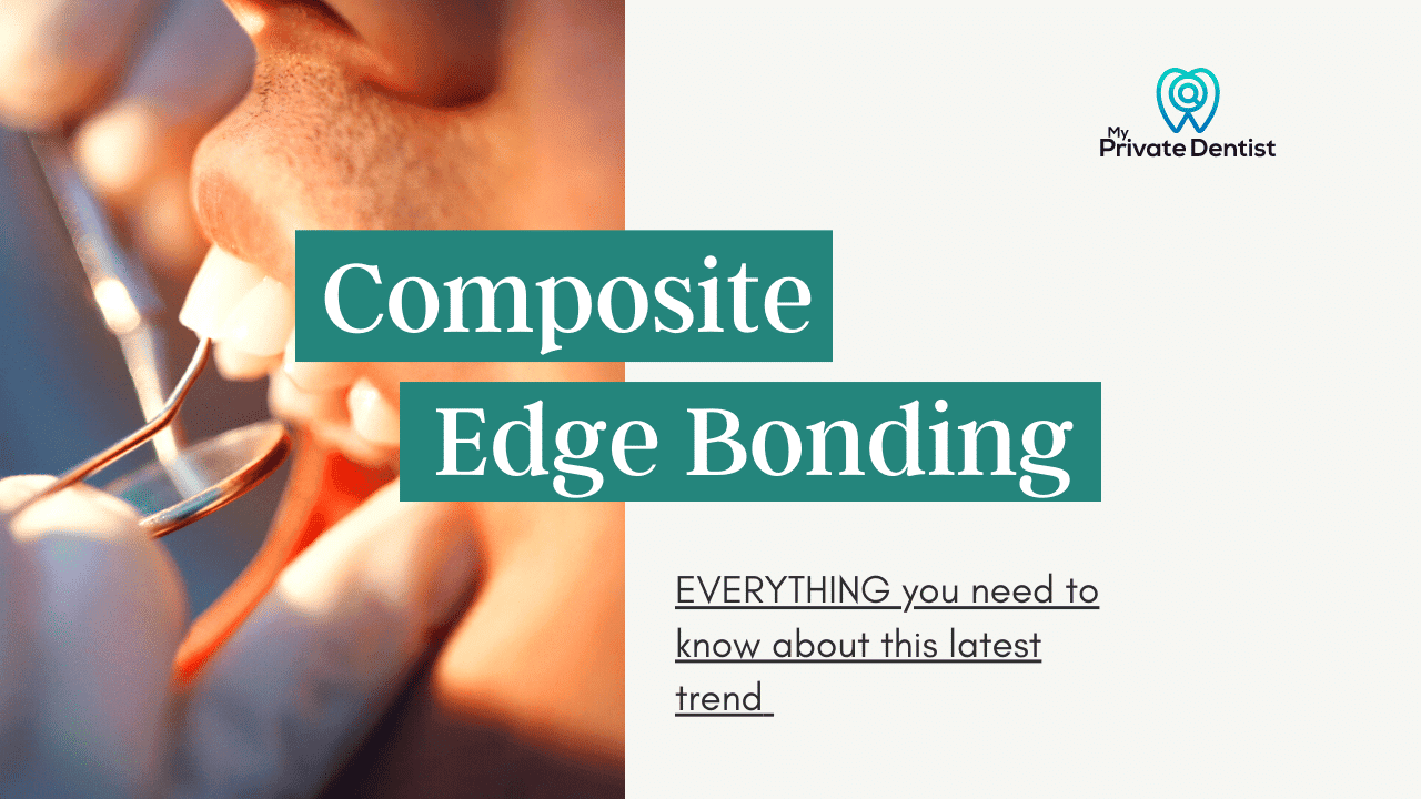 Composite Edge Bonding: 15 Things You Need To Know