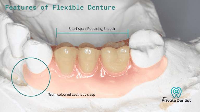 Flexible Dentures: 9 Reasons They May Be Better Than The Traditional ...