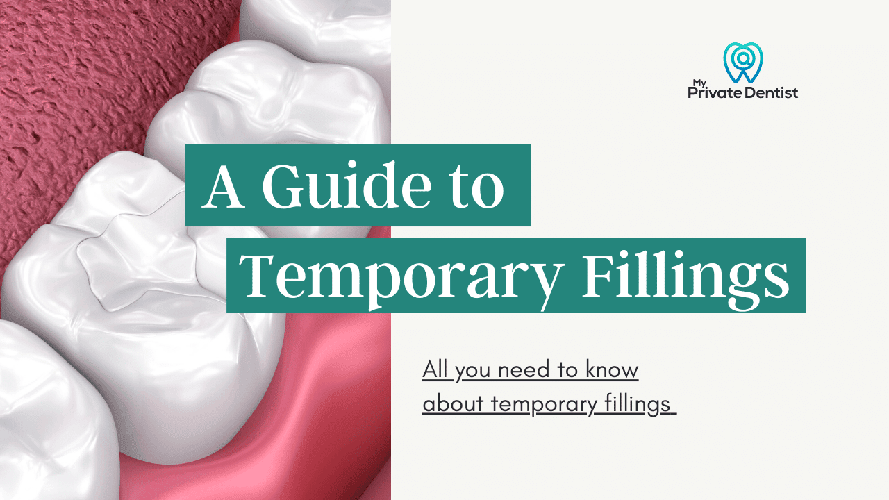 Temporary Filling: How Long Will It Last? What 4 Things To Avoid