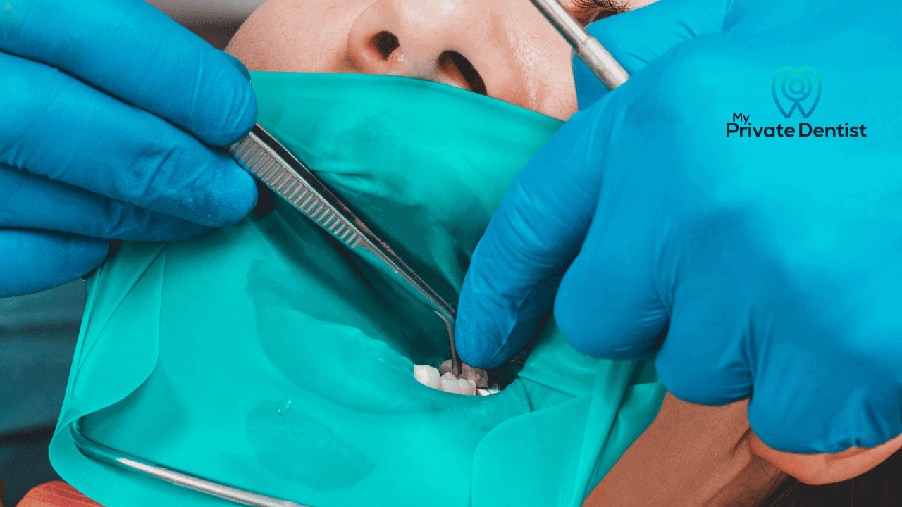 Root Canal Vs Extraction: Making The Right Choice