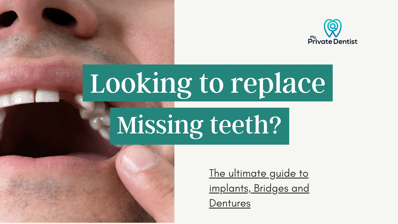 Tooth Replacement: A Review Of Options For Missing Teeth