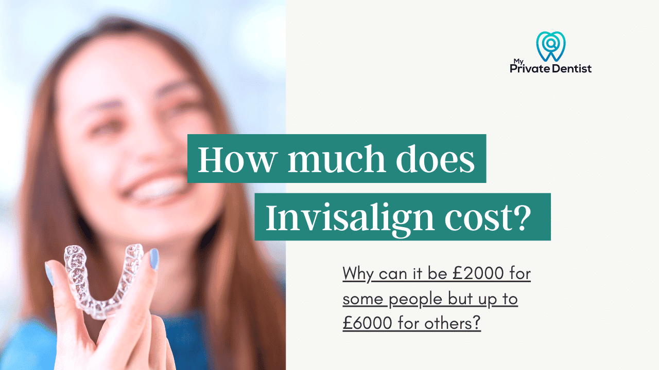 What Is Invisalign Cost UK: Is It Worth The Price?