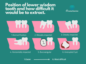 Wisdom Tooth Pain: 5 Ways To Treat It At Home And When To See A Dentist