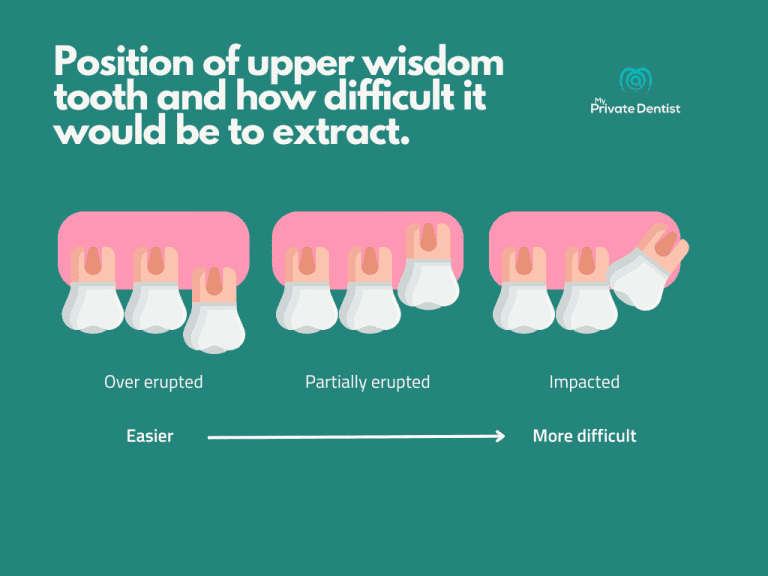 Wisdom Tooth Pain: 5 Ways To Treat It At Home And When To See A Dentist