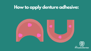 5 Best Denture Adhesives (2025): For A Secure, All-Day Hold - My ...