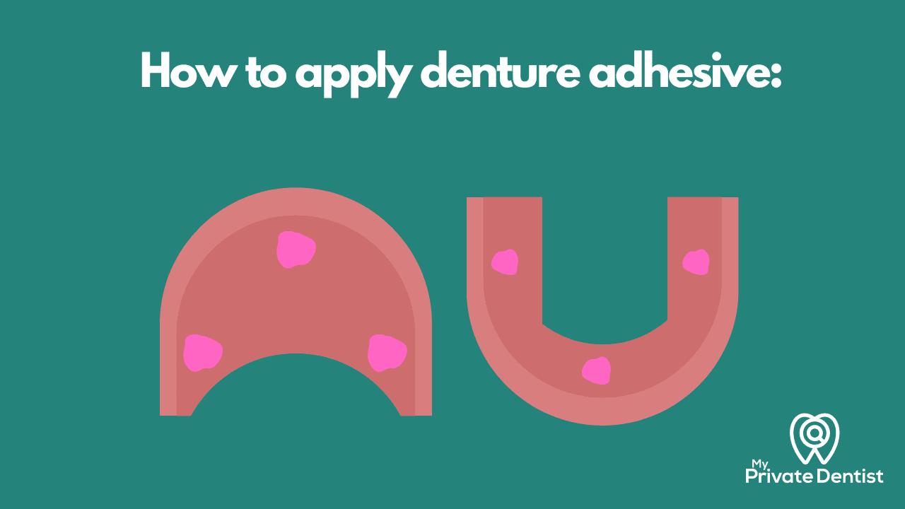 5 Best Denture Adhesives (2025): For A Secure, All-Day Hold - My ...