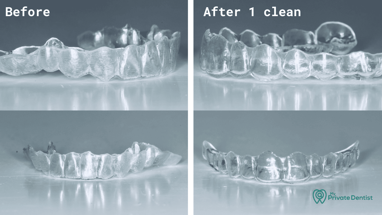 Retainer Cleaner Review- Zima Dental Pod