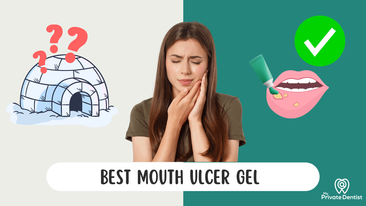 6 Best Mouth Ulcer Gels (2025): A Dentist's Guide To Fast Healing - My ...