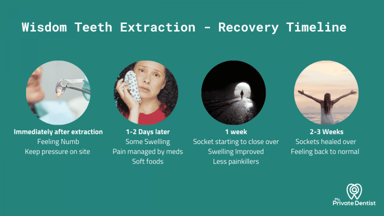 Wisdom Teeth Recovery Timeline: A Dentist's Guide To Post-Extraction ...