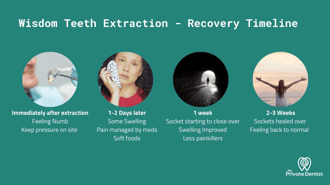 Wisdom Teeth Recovery Timeline: A Dentist's Guide To Post-Extraction ...