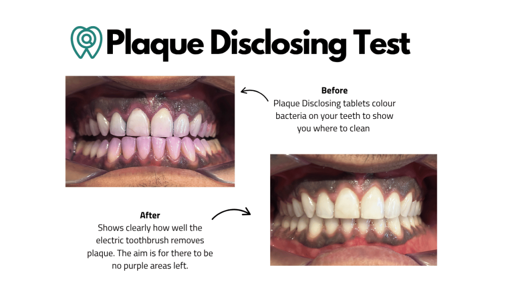 Best Electric Toothbrushes 2025: Top Picks For Every Budget (UPDATED ...